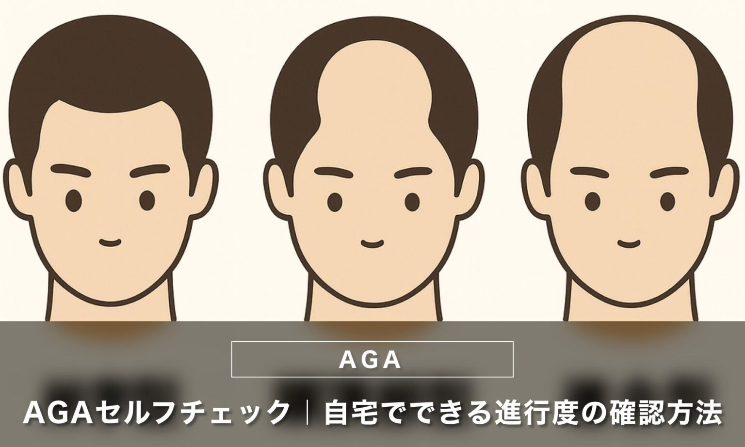 AGAセルフチェック｜自宅でできる進行度の確認方法